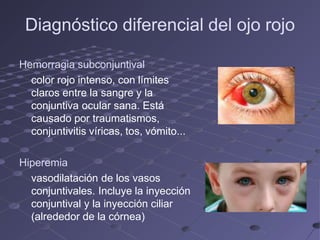 ALTERACIONES OFTALMOLOGICAS.pptx