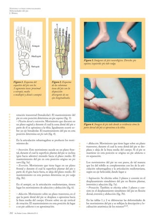 Alteraciones ortopedicasdelpie | PDF