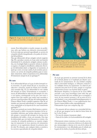 Alteraciones ortopedicasdelpie | PDF