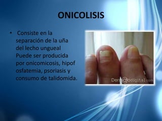 Alteraciones patologicas de pelo y uñas | PPTX