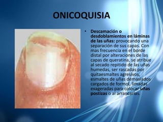 Alteraciones patologicas de pelo y uñas | PPTX
