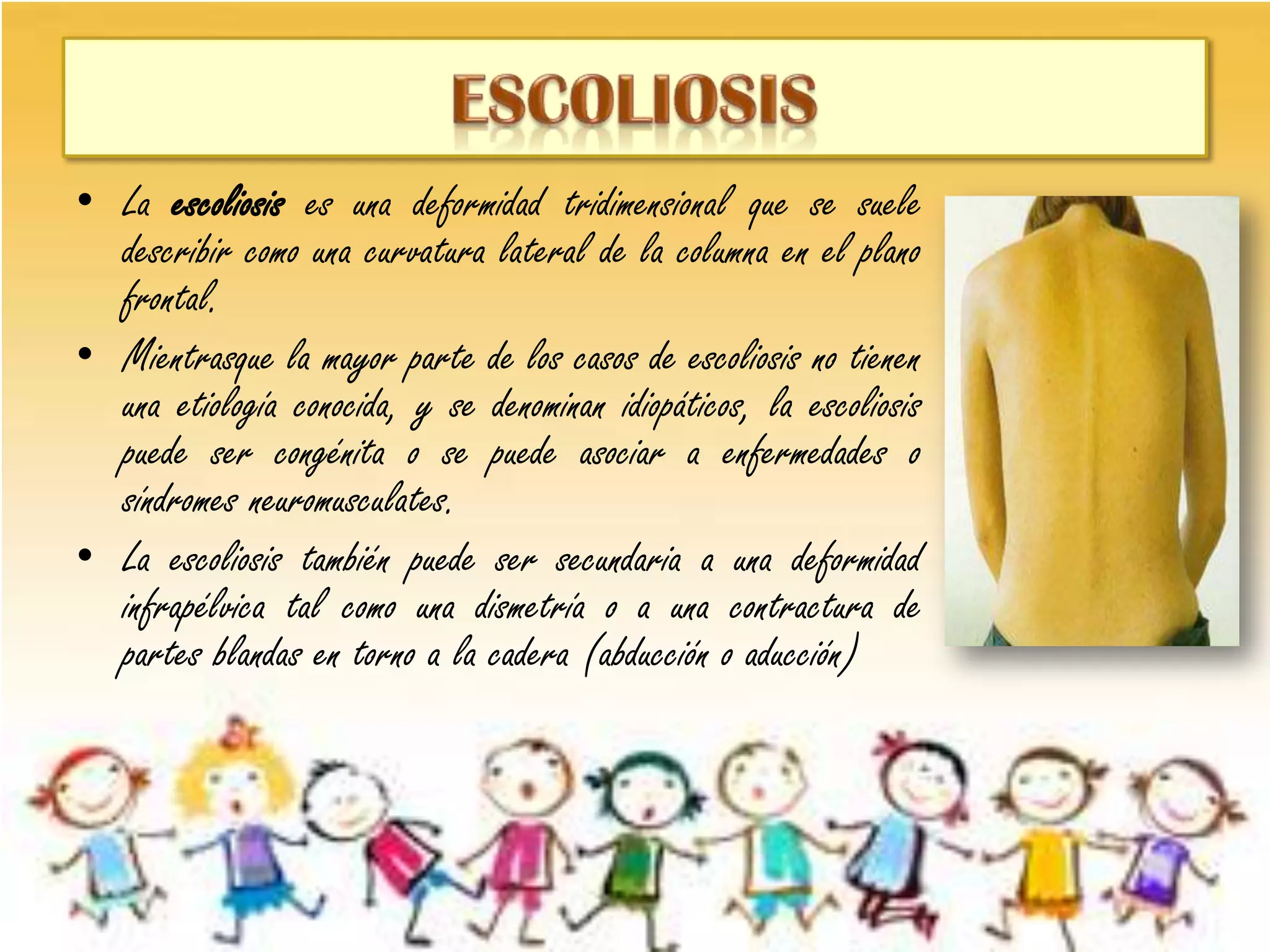 Alteraciones Posturales - Pediatría | PPTX