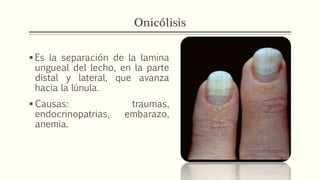 Alteraciones uñas. semiolog | PPTX
