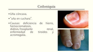 Alteraciones uñas. semiolog | PPTX