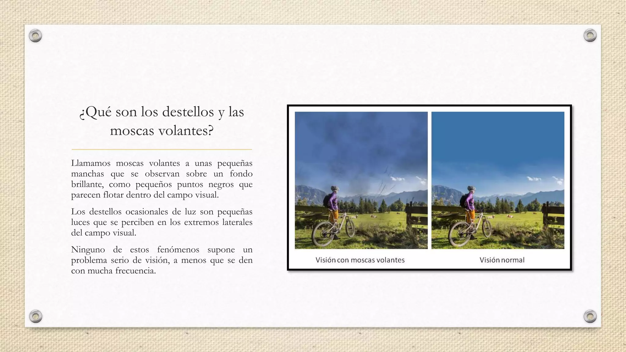 Alteraciones visuales-1.pptx