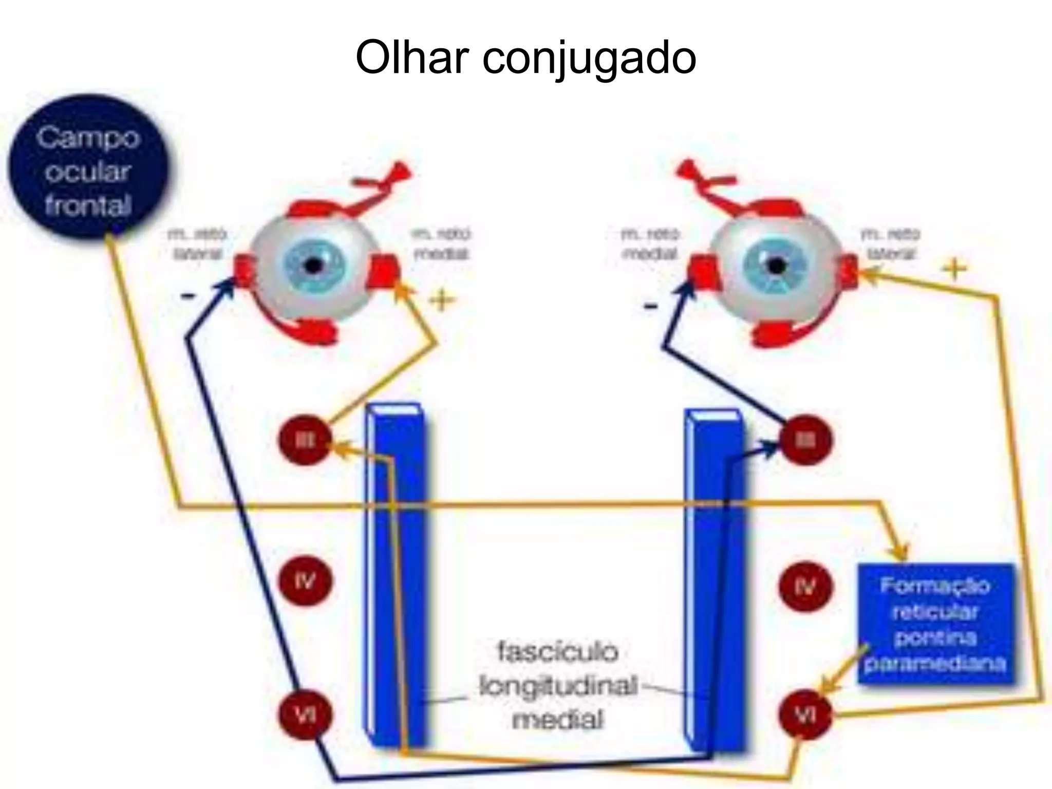 Alteração visual e sintomas correlatos | PPT