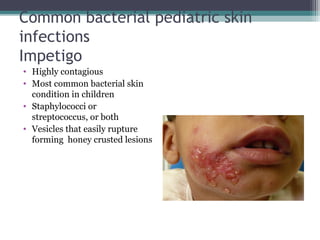 Alteration in skin integrity | PPT