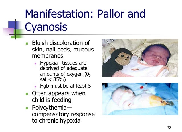 Alterations in cardiovascular function in children
