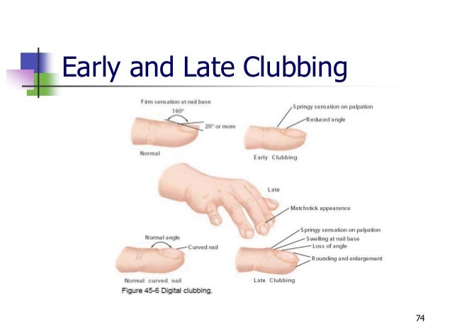 Alterations in cardiovascular function in children