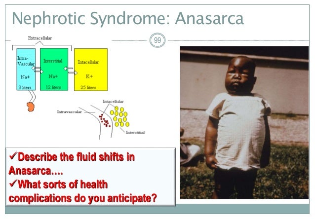 Alterations in genitourinary function in children