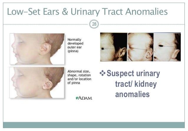 Alterations in genitourinary function in children fall 2017