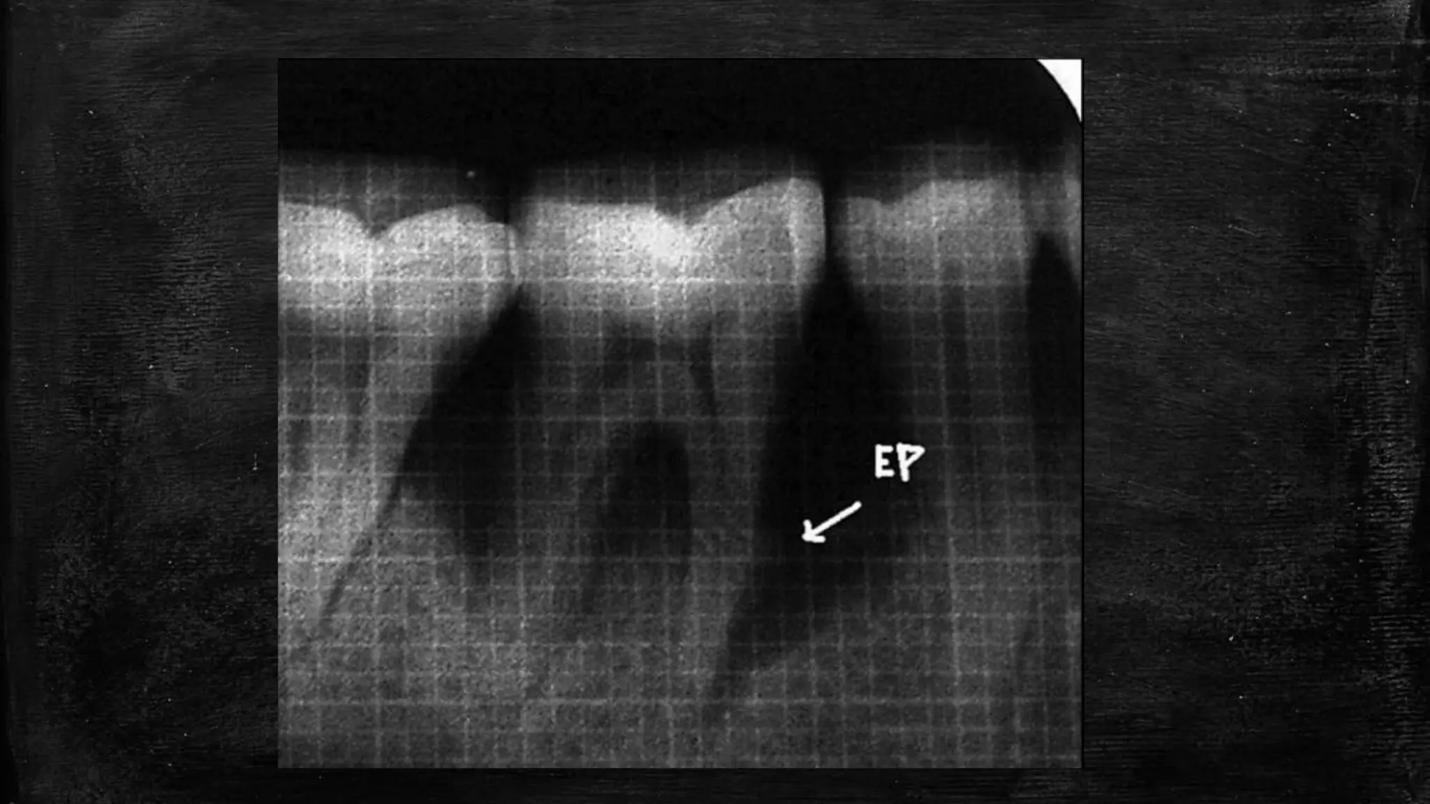Alterations in tooth morphology | PPTX | Dental Health | Diseases and ...