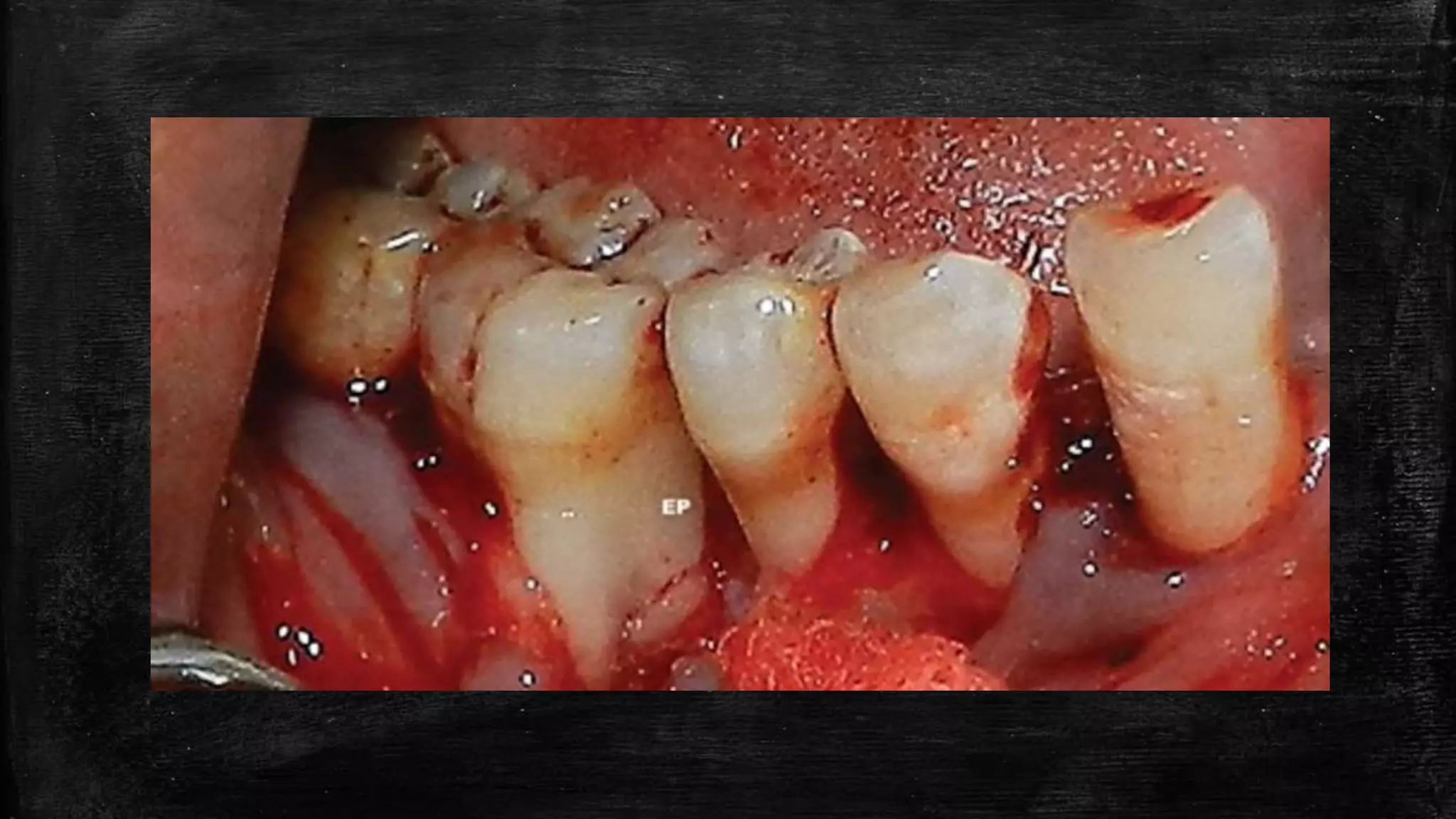 Alterations in tooth morphology | PPTX | Dental Health | Diseases and ...