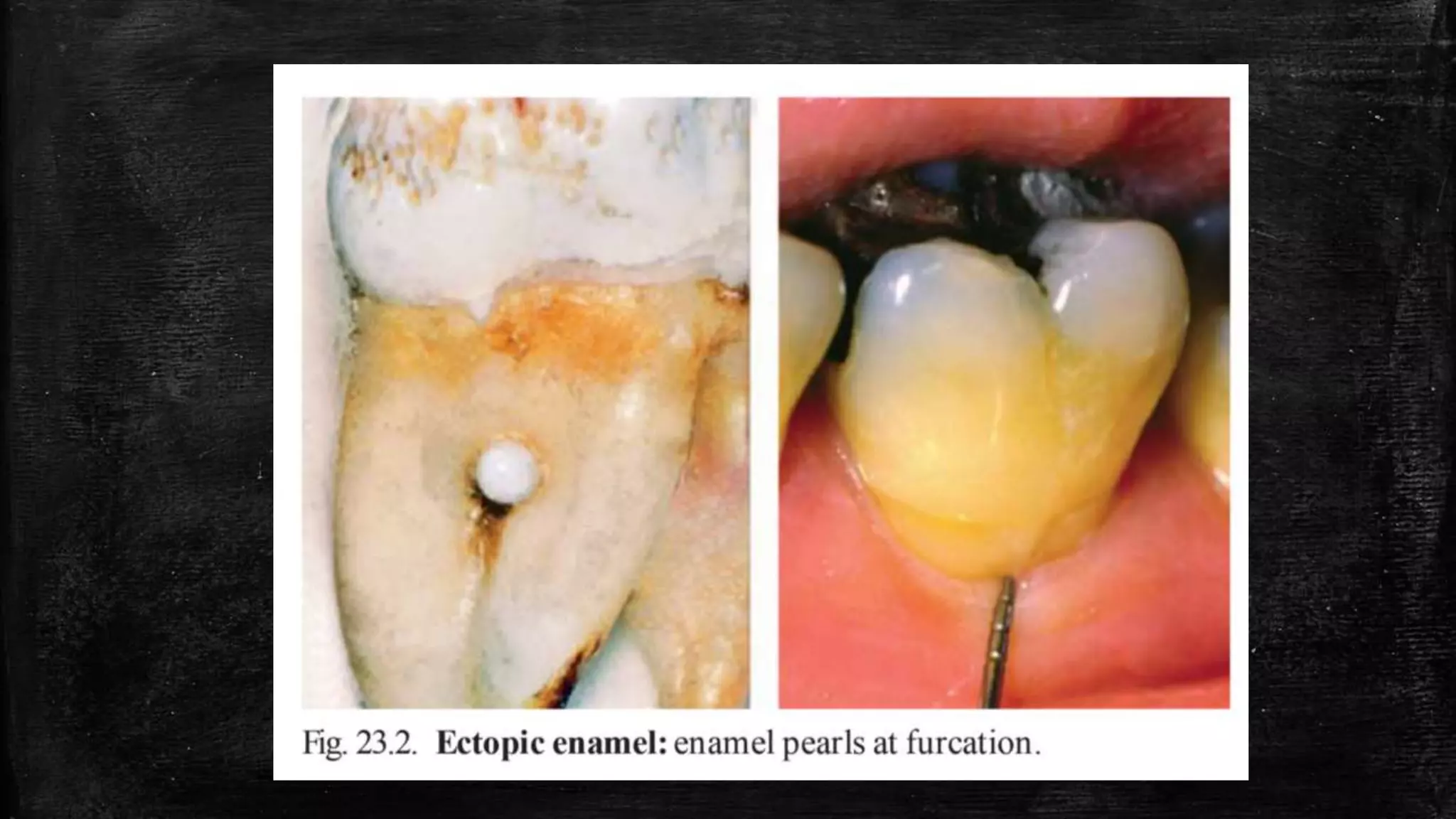 Alterations in tooth morphology | PPTX | Dental Health | Diseases and ...