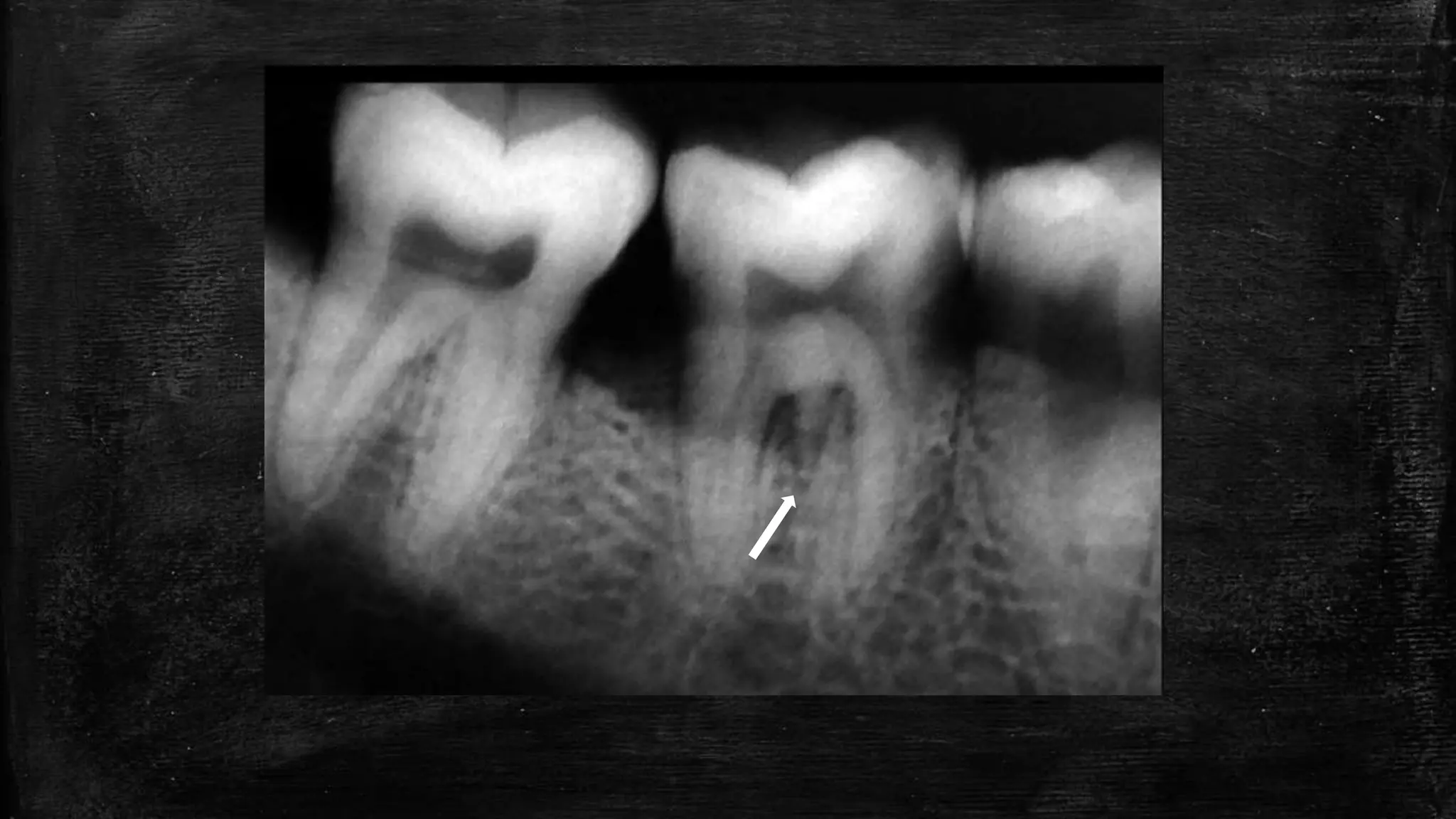 Alterations in tooth morphology | PPTX | Dental Health | Diseases and ...