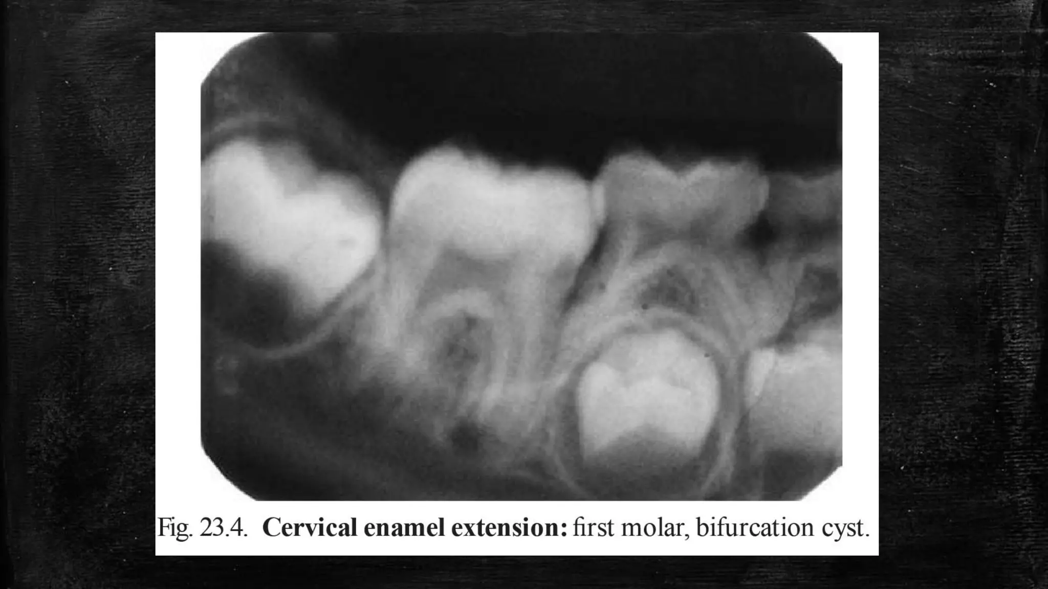 Alterations in tooth morphology | PPTX | Dental Health | Diseases and ...