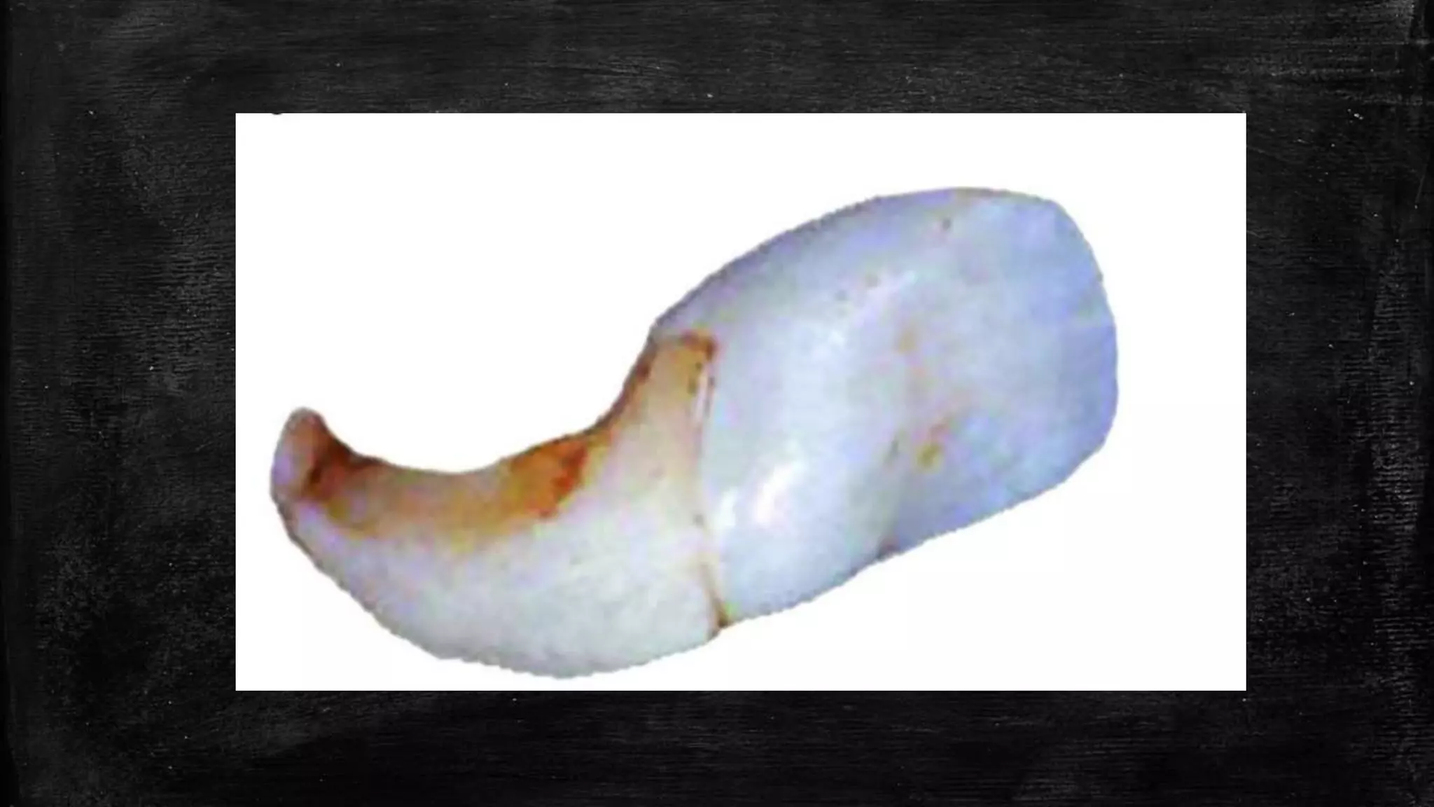 Alterations in tooth morphology | PPTX | Dental Health | Diseases and ...