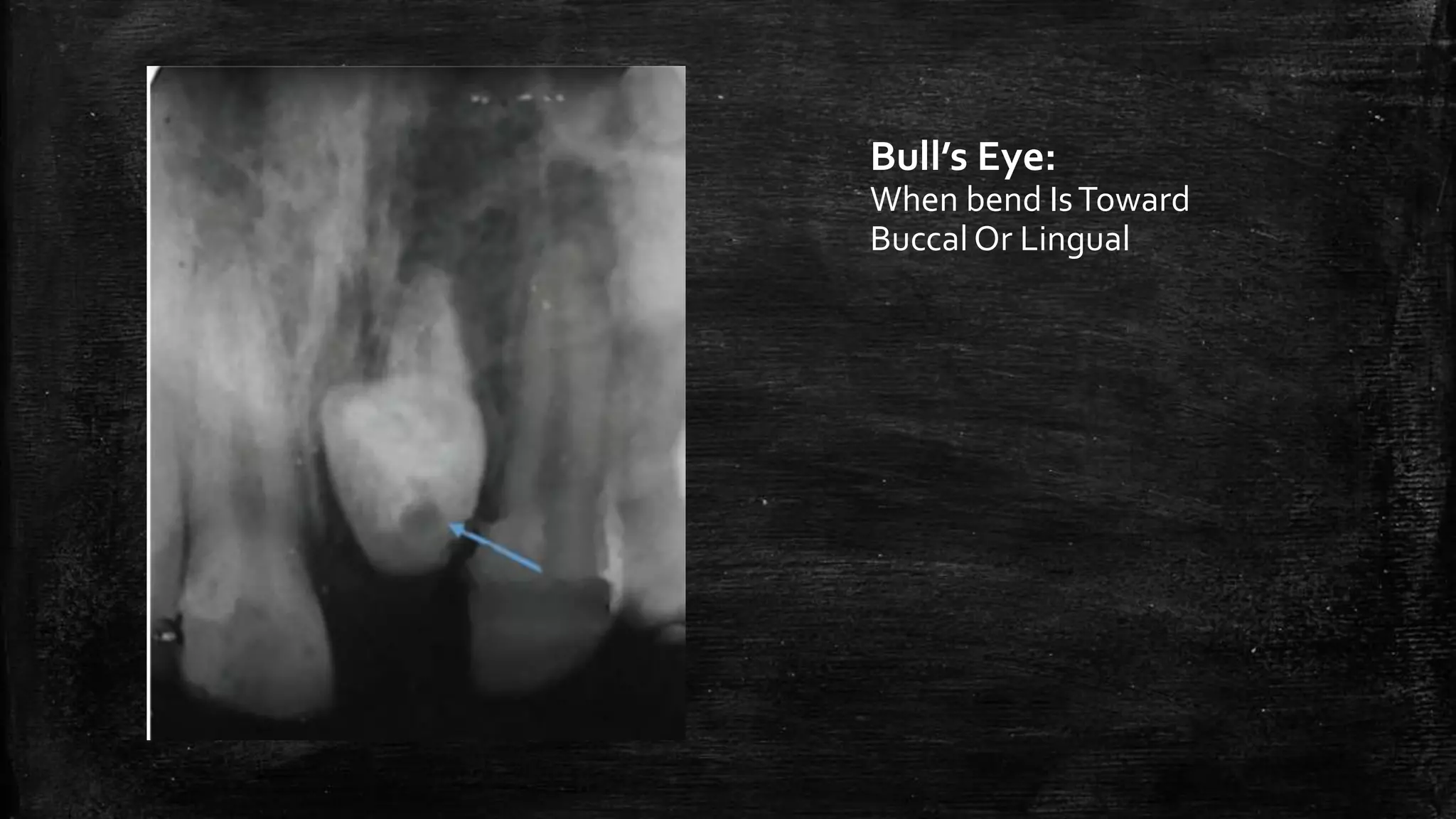 Alterations in tooth morphology | PPTX | Dental Health | Diseases and ...