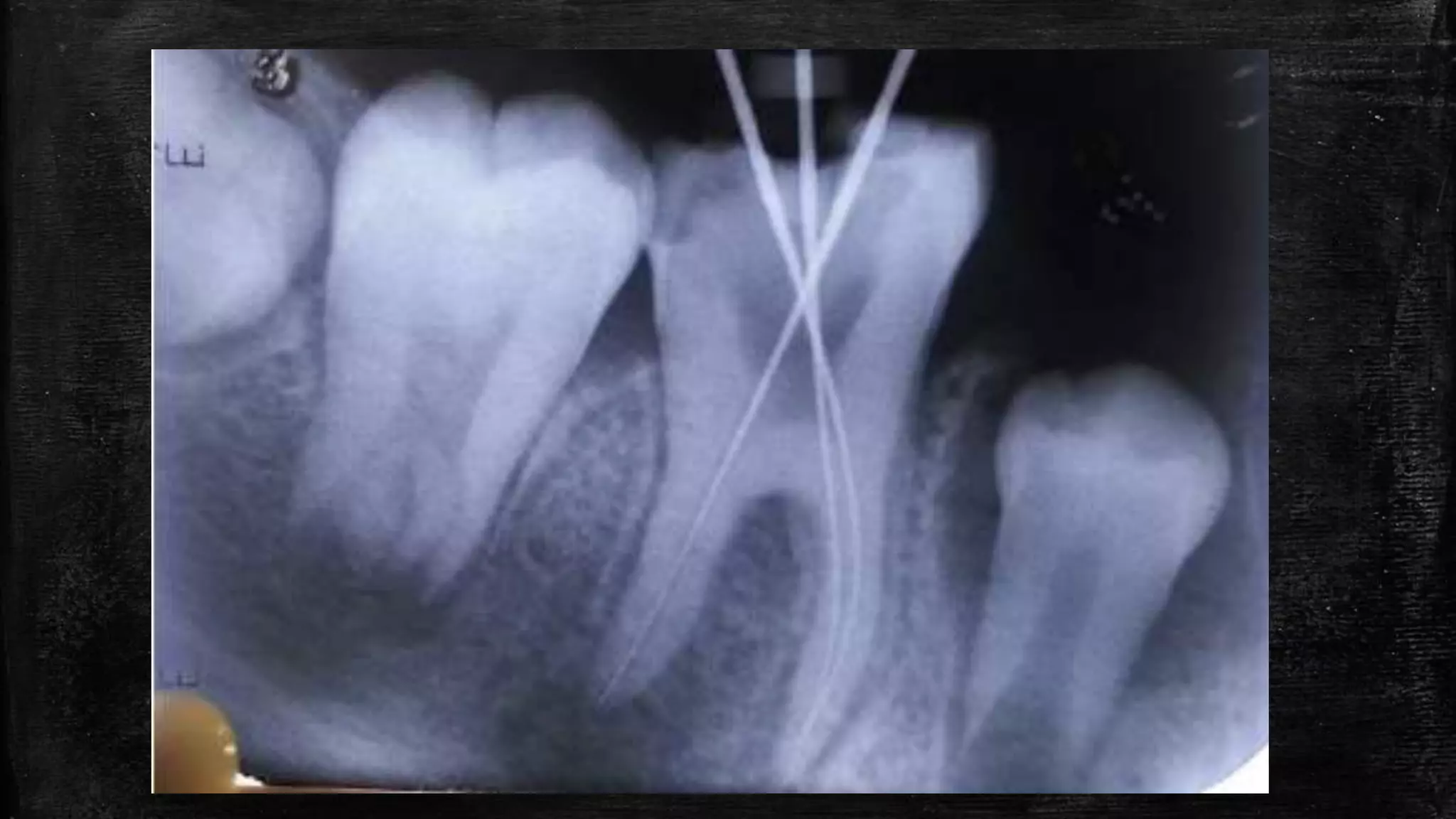 Alterations in tooth morphology | PPTX | Dental Health | Diseases and ...