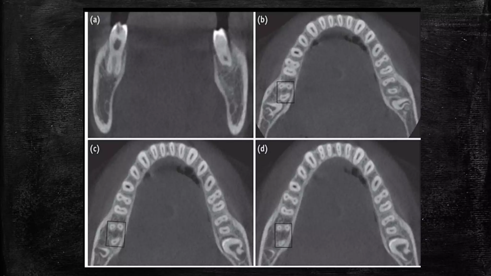 Alterations in tooth morphology | PPTX | Dental Health | Diseases and ...