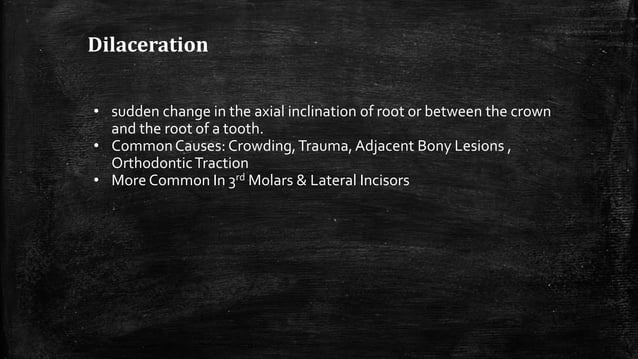 Alterations in tooth morphology | PPTX | Dental Health | Diseases and ...