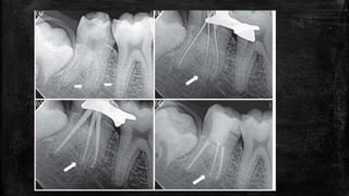 Alterations in tooth morphology | PPTX