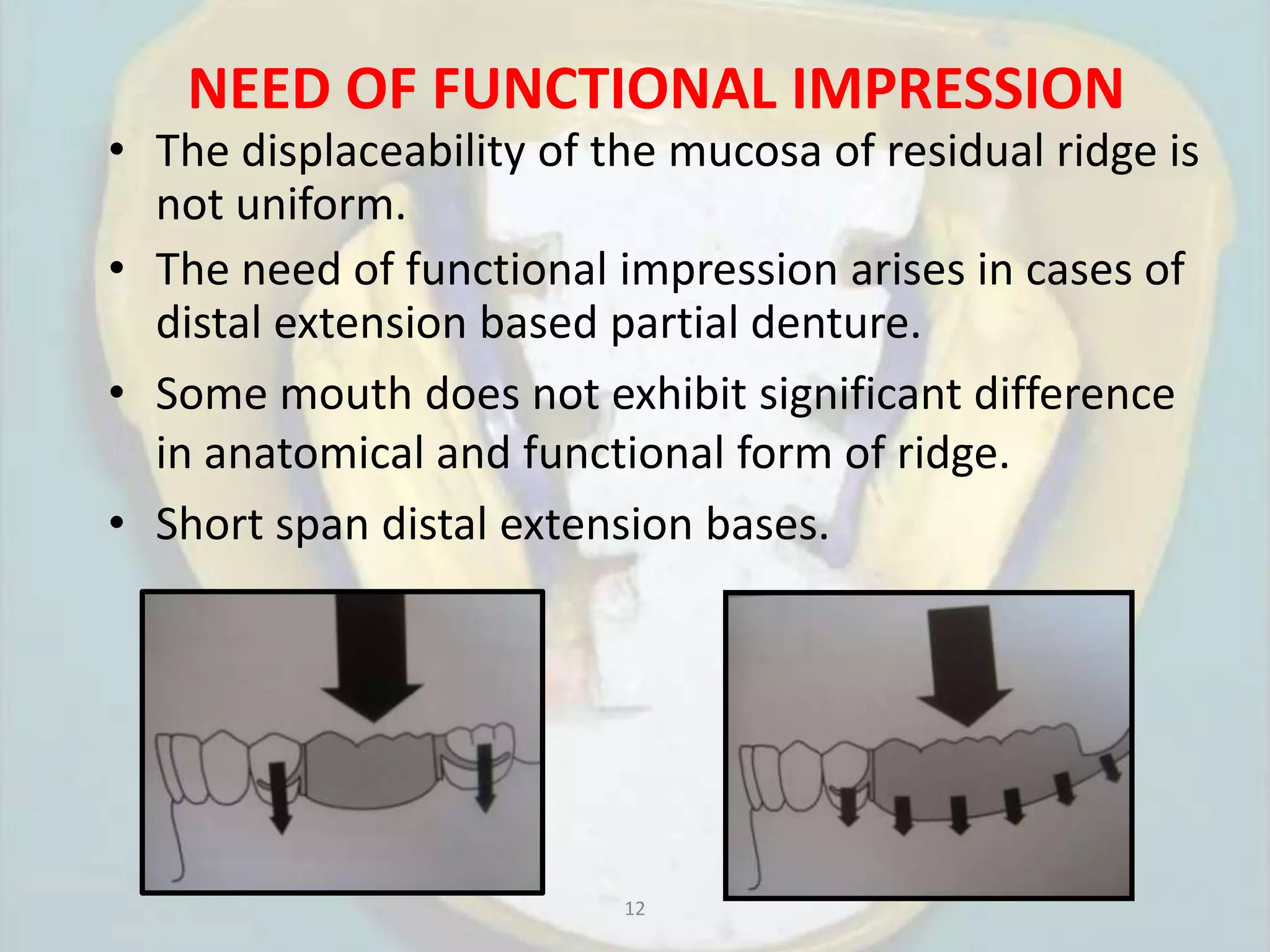 Altered casts technique | PPTX