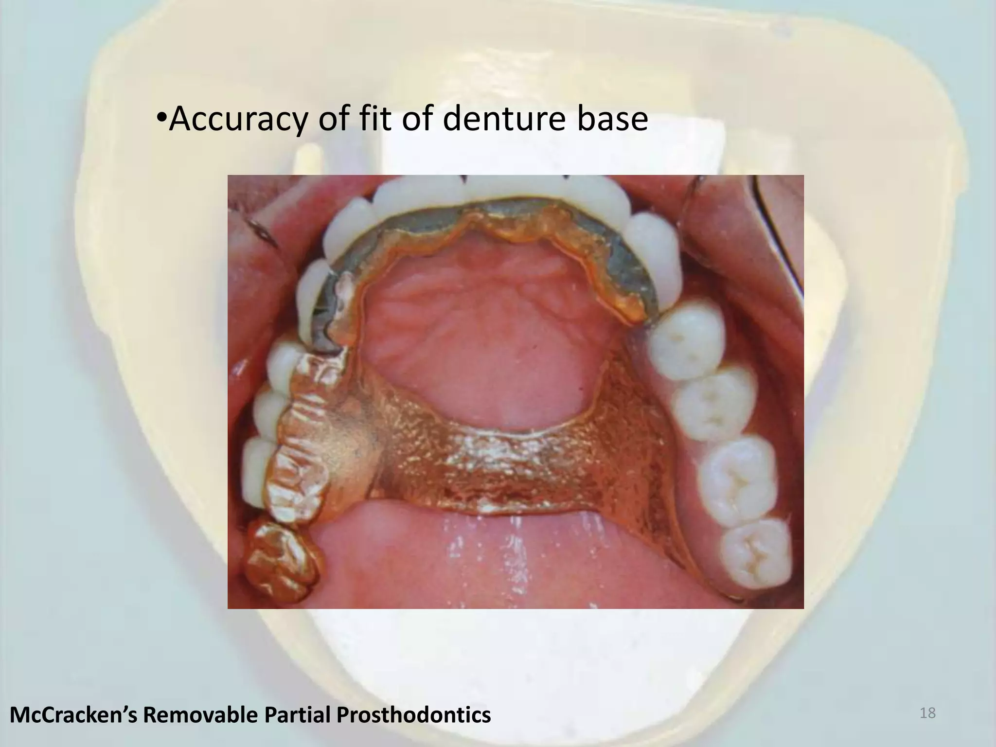 Altered casts technique | PPTX