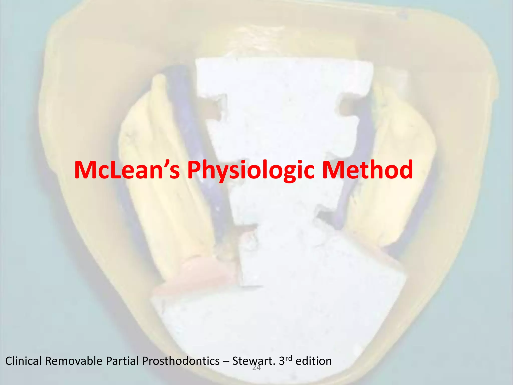 Altered casts technique | PPTX