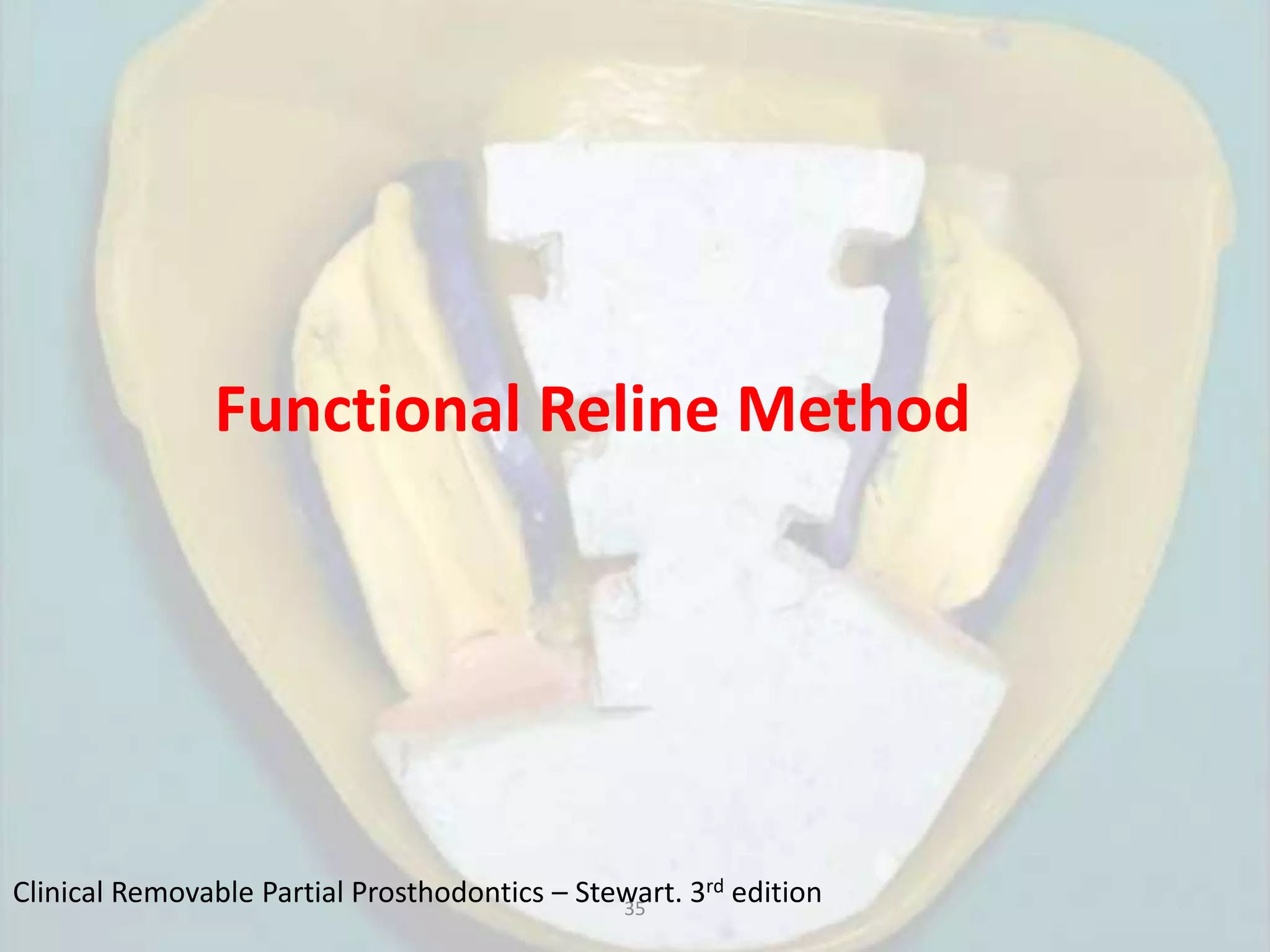 Altered casts technique | PPTX