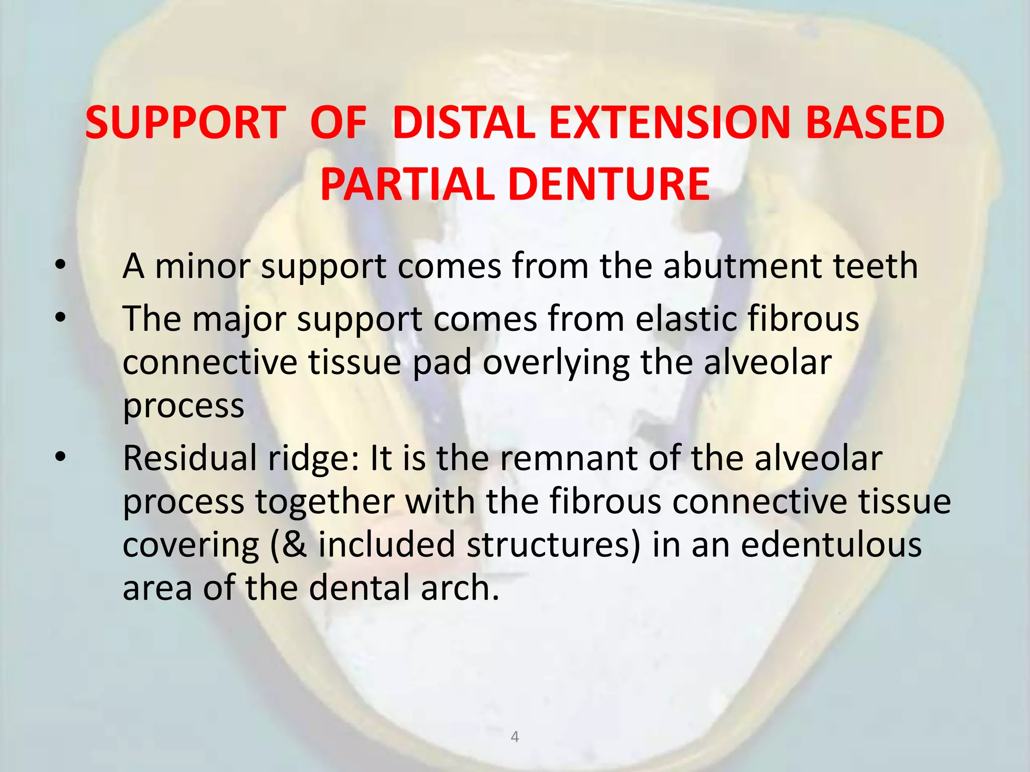 Altered casts technique | PPTX