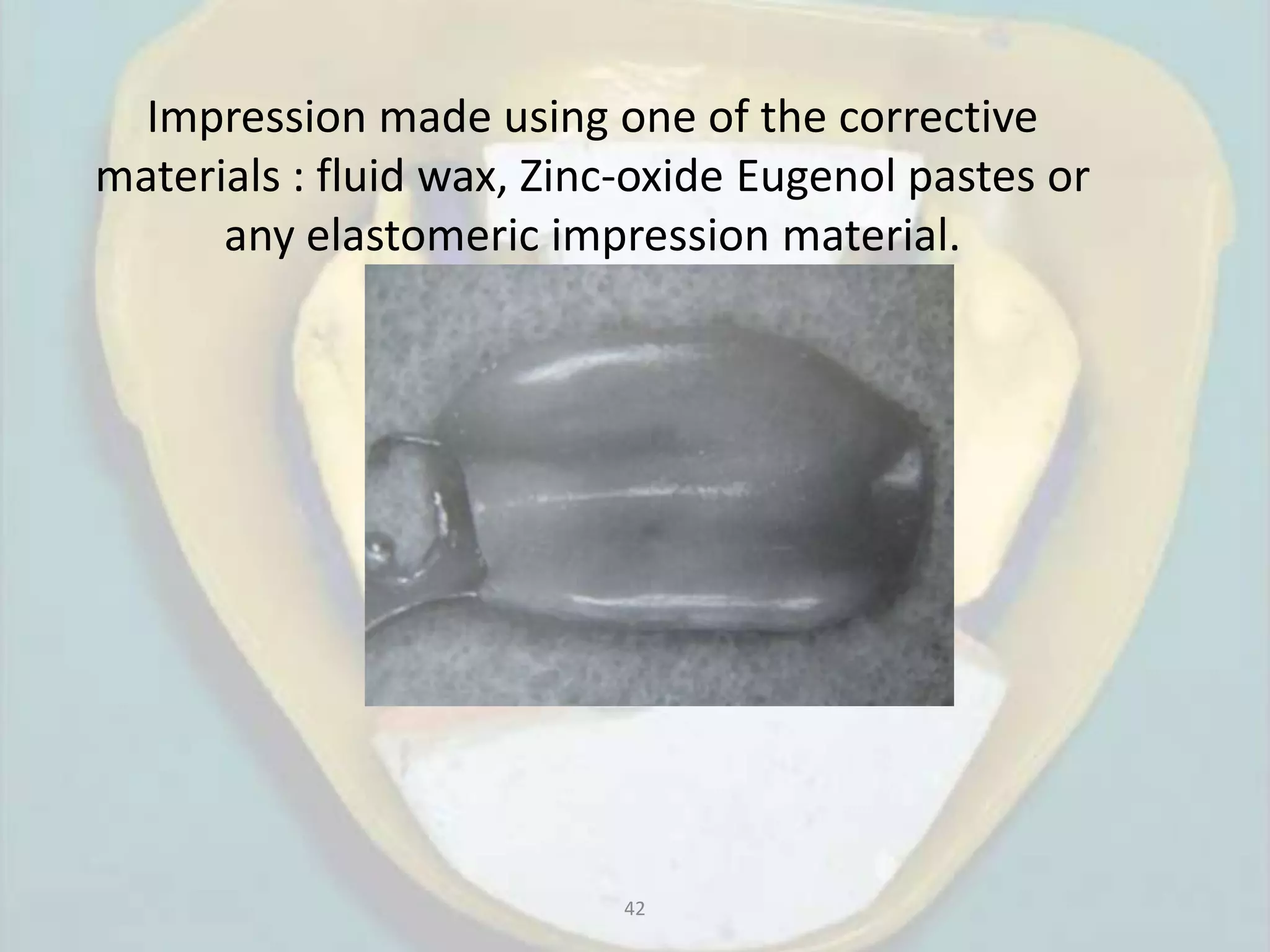 Altered casts technique | PPTX