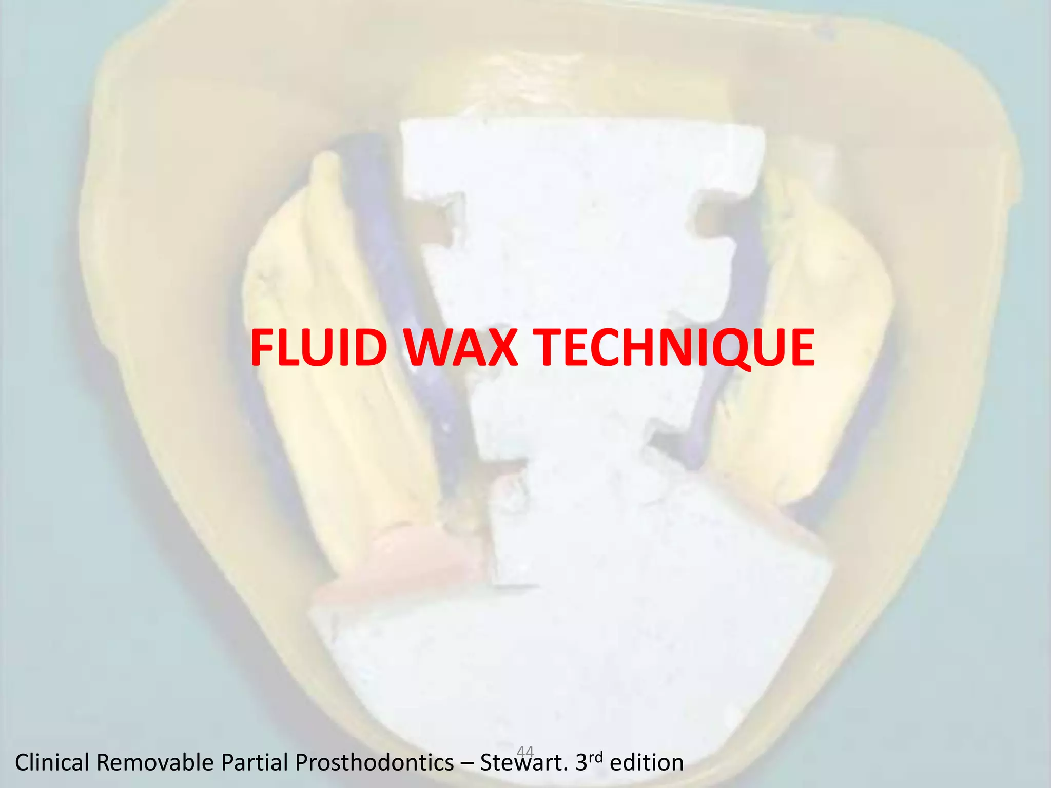 Altered casts technique | PPTX