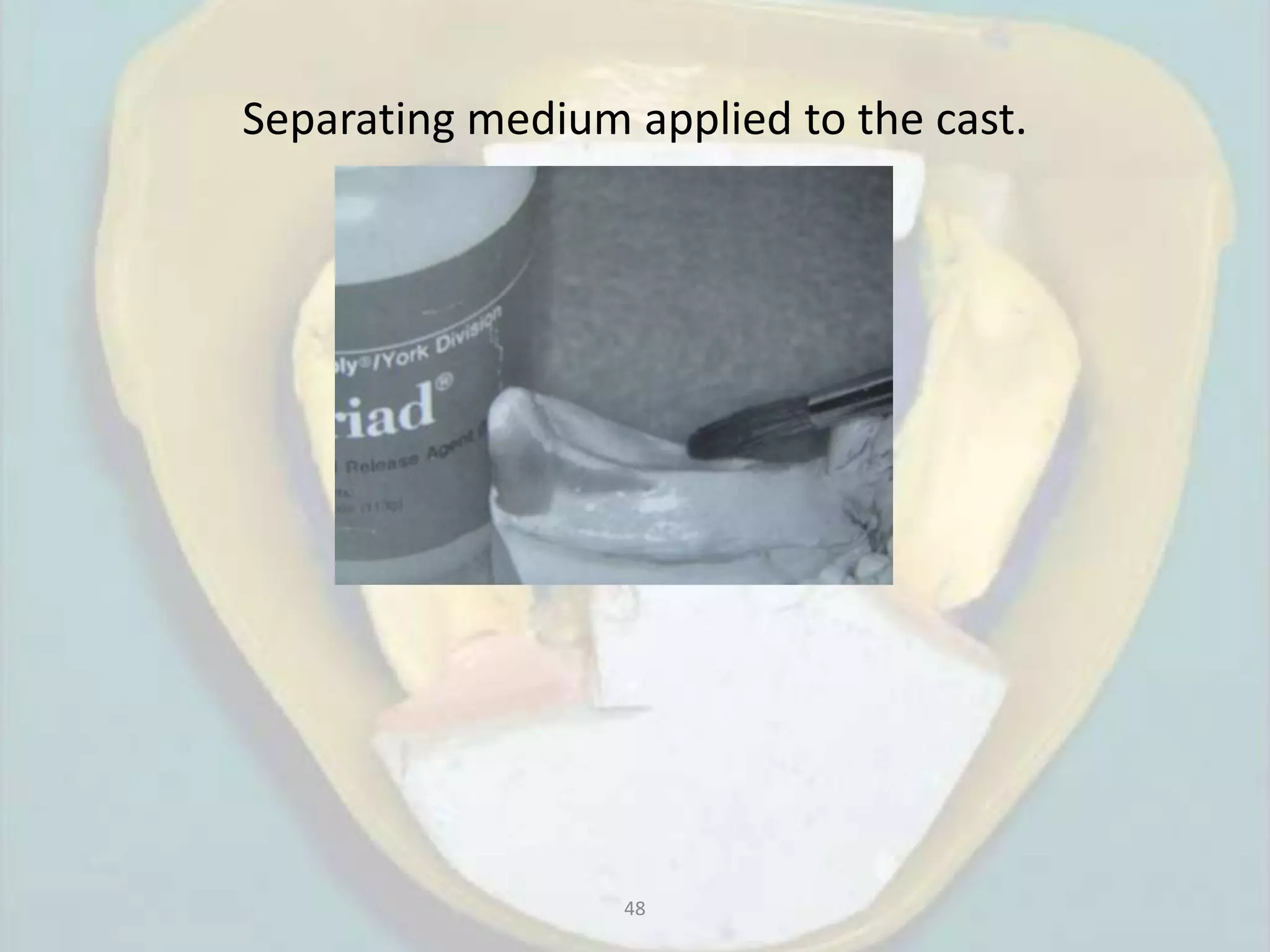 Altered casts technique | PPTX