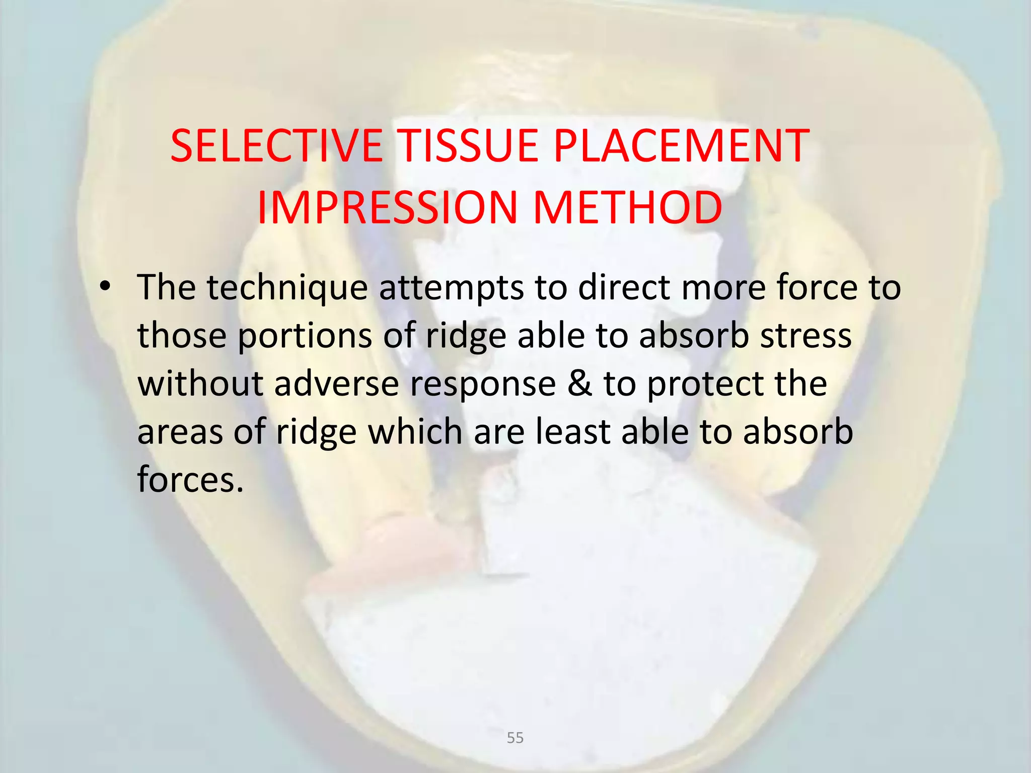 Altered casts technique | PPTX