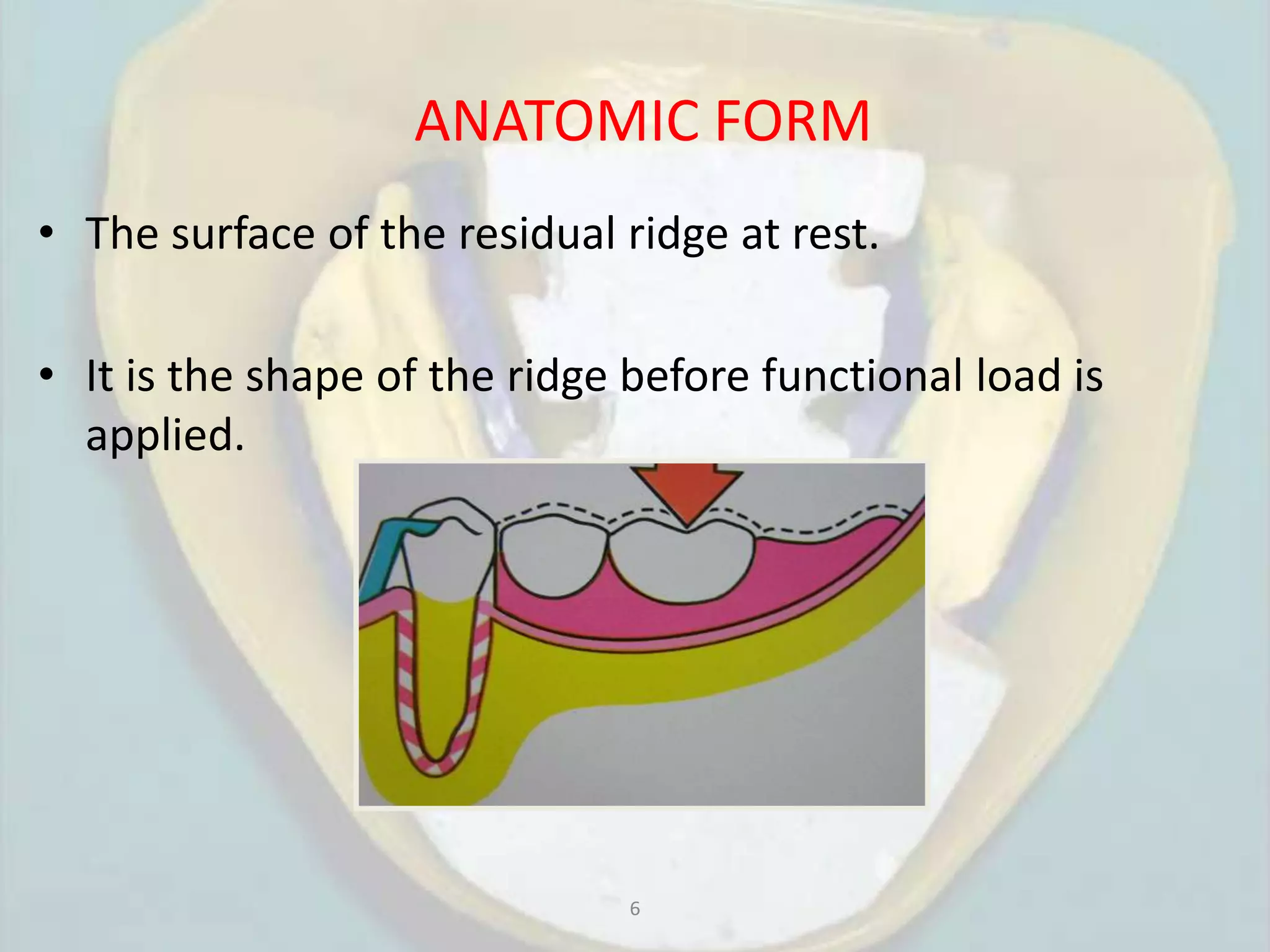 Altered casts technique | PPTX