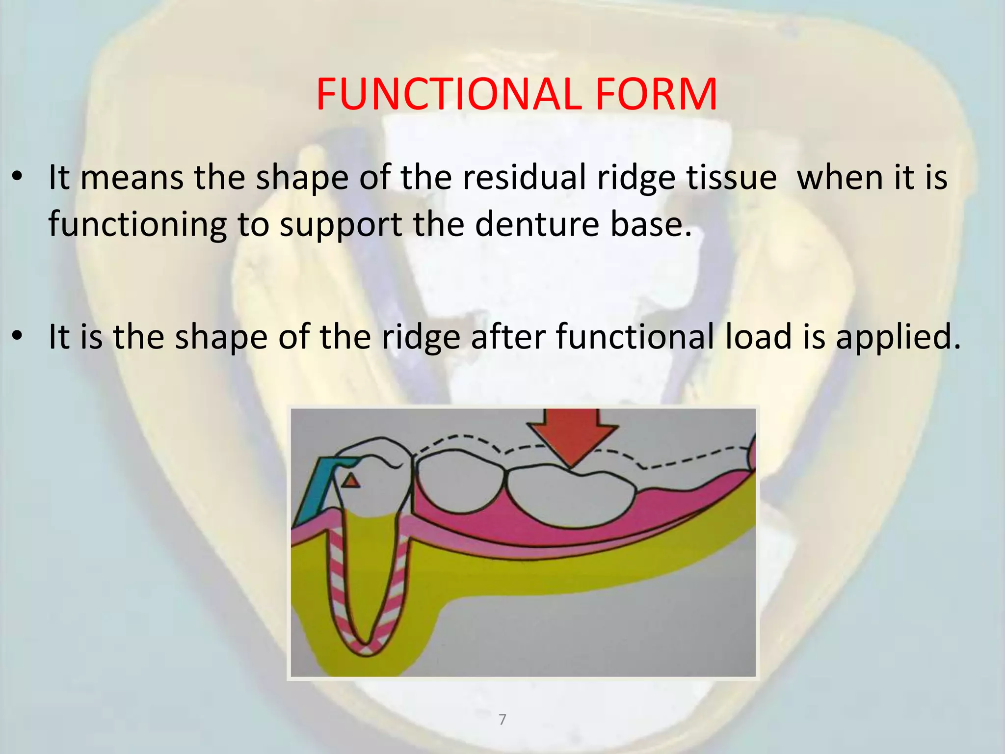Altered casts technique | PPTX