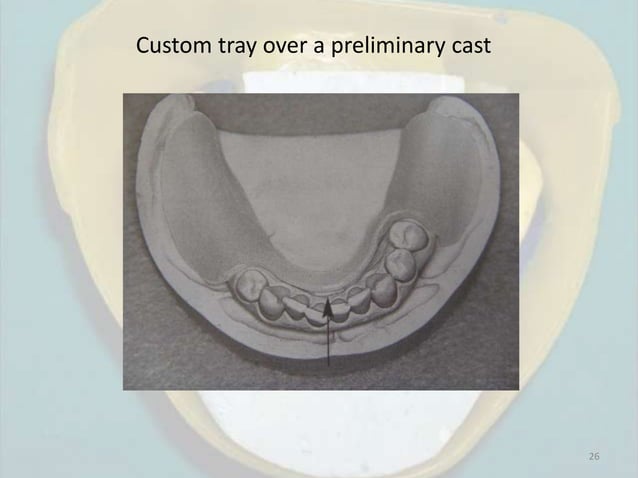 Altered casts technique | PPTX