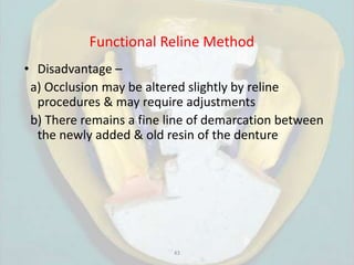 Altered casts technique | PPTX