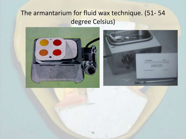 Altered casts technique | PPTX