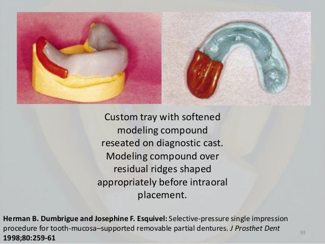 Altered casts technique