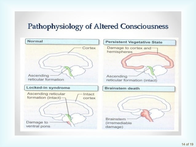 Altered Level of Consciousness | PPT