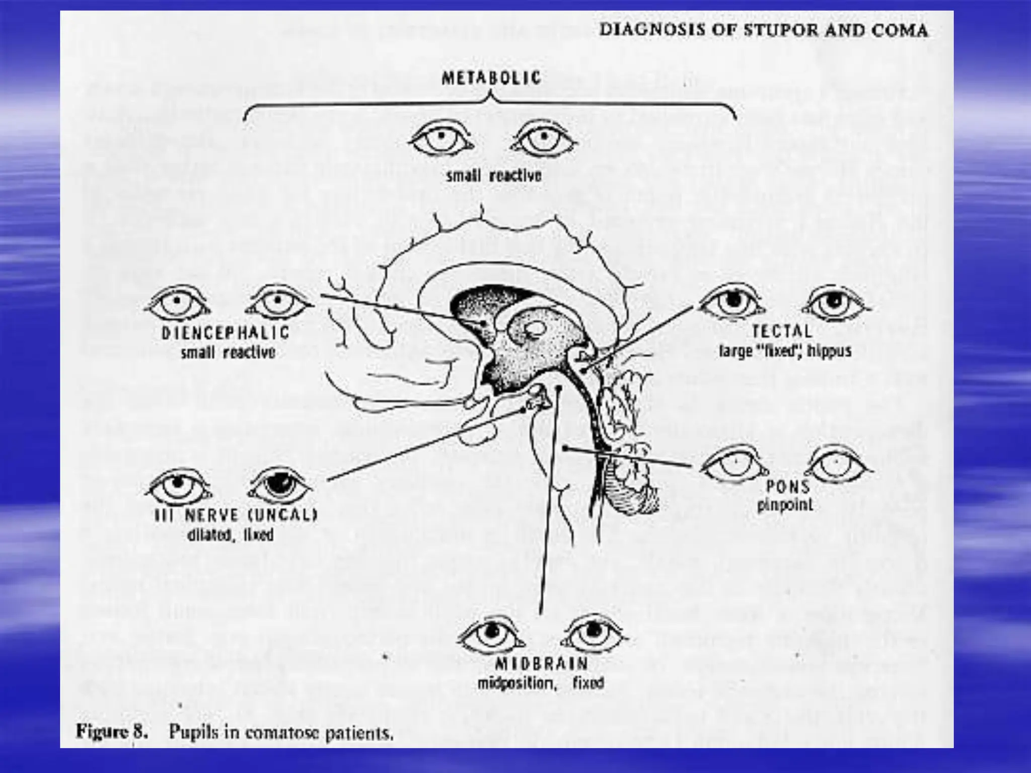 alteredsensoriumfinal-121001012445-phpapp02.pdf | Brain and Nervous ...
