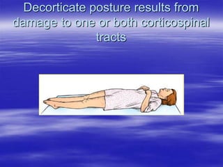 alteredsensoriumfinal-121001012445-phpapp02.pdf | Brain and Nervous ...