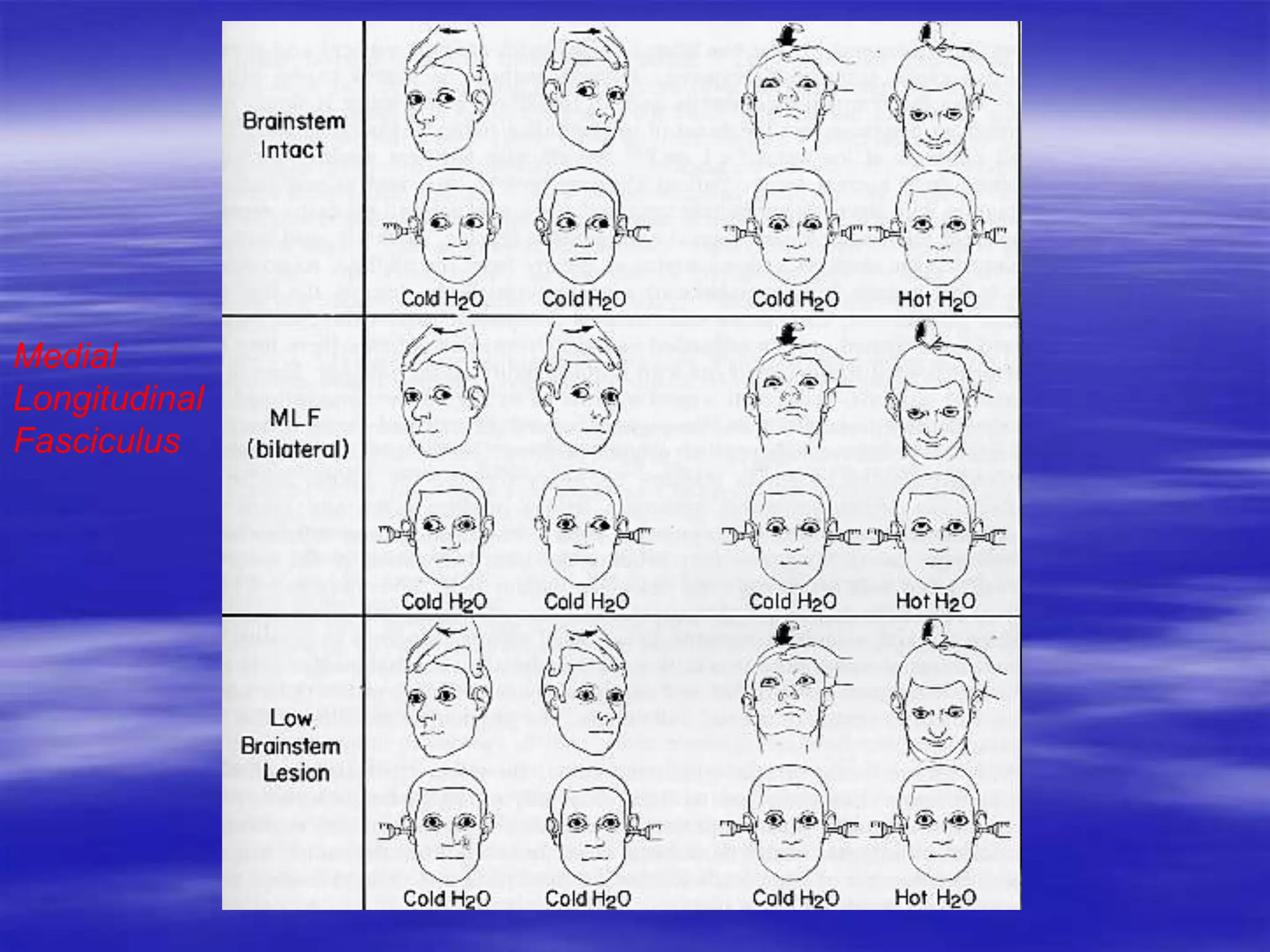Altered sensorium | PPTX