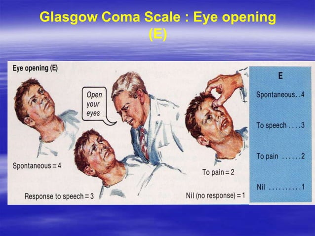 Altered sensorium | PPTX