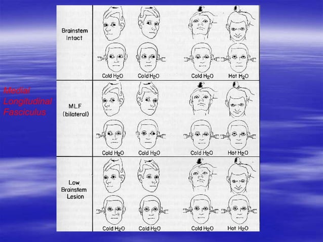 Altered sensorium | PPTX