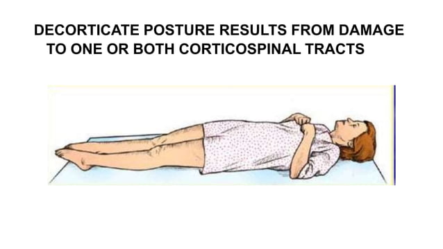ALTERED SENSORIUM PPT.pptx | Brain and Nervous System Disorders ...