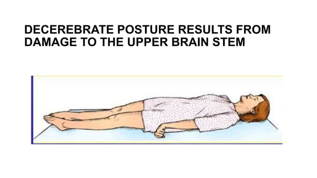 ALTERED SENSORIUM PPT.pptx | Brain and Nervous System Disorders ...