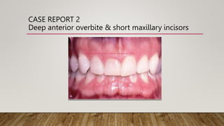 Altering vertical dimension of occlusion.pptx